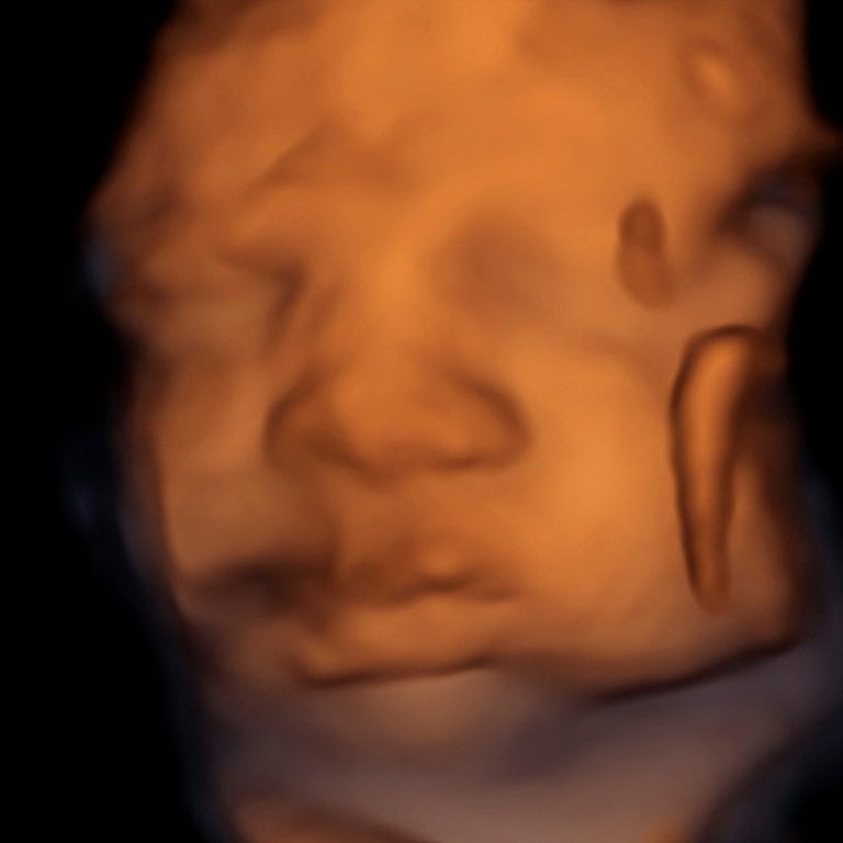 8k Enhanced Image Ultrasound - GoldenView Ultrasound