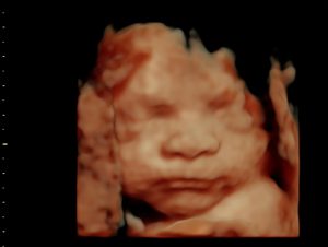8k Enhanced Image Ultrasound - GoldenView Ultrasound