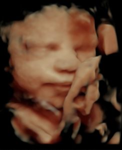8k Enhanced Image Ultrasound - GoldenView Ultrasound