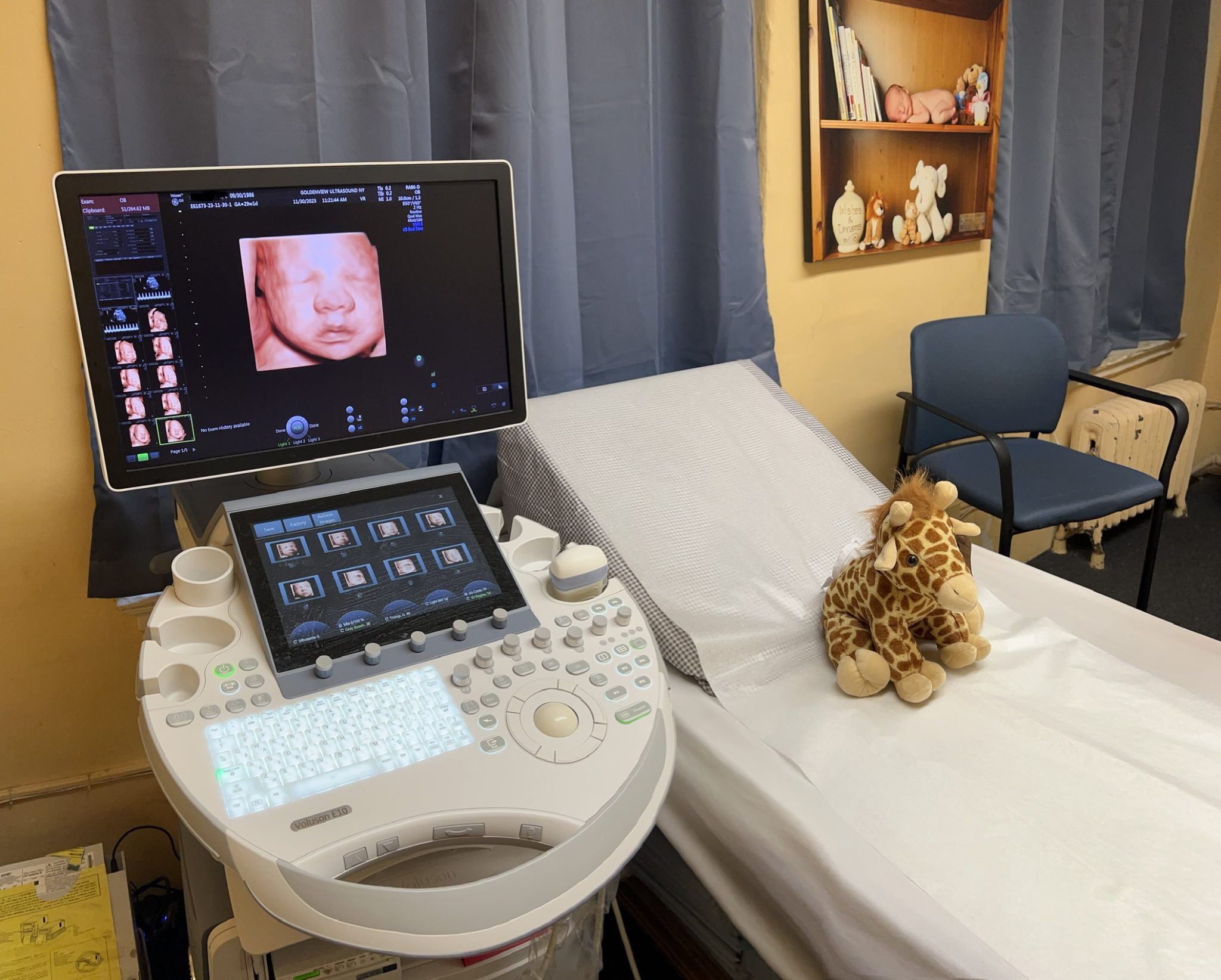 The Best Time for 4D Ultrasound: Essential Tips for Expecting Parents